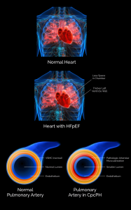 Tectonic Therapeutic - Homepage - Tectonic Therapeutic